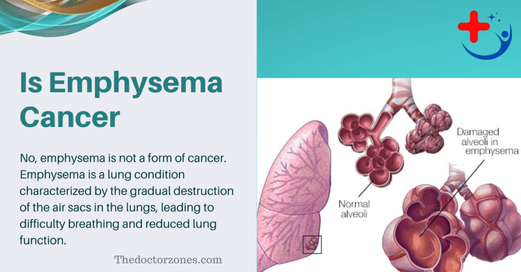 Is Emphysema Cancer: What causes emphysema - Thedoctorzones